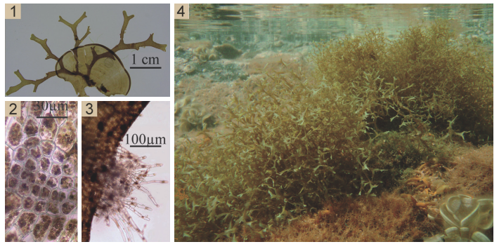 Corallina Under Microscope